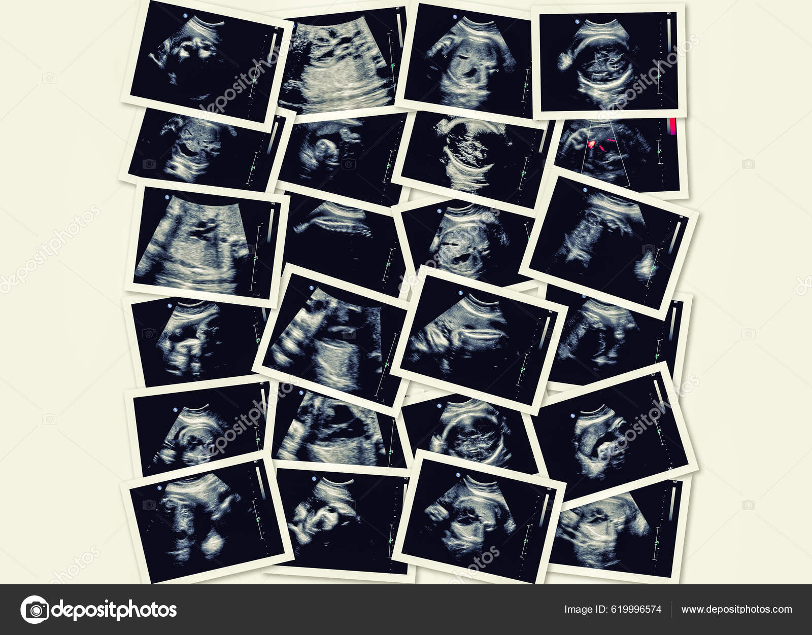 Collection Images Ultrasound Scan Examination Fetus 7Th Month — Stock ...