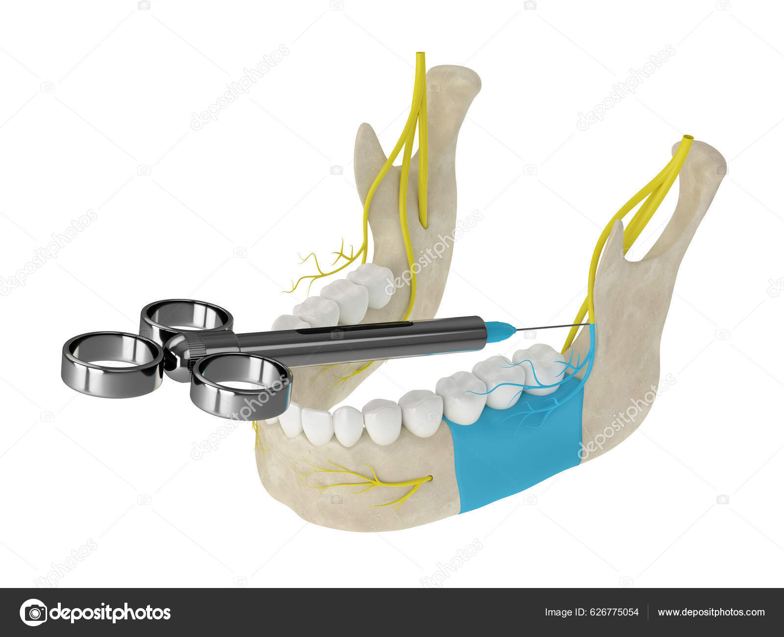 Bloqueo Del Nervio Alveolar Superior