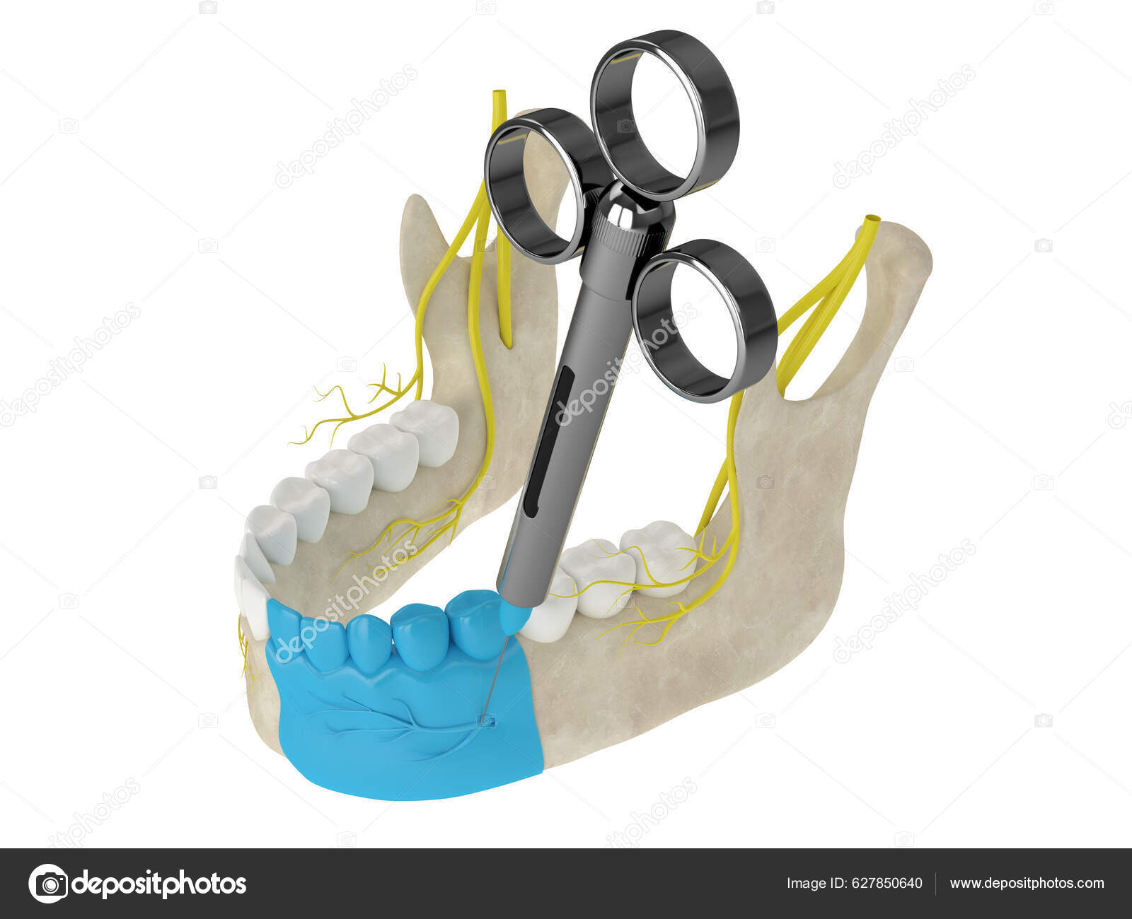 Types Of Anesthesia Nerve Blocks - Infoupdate.org