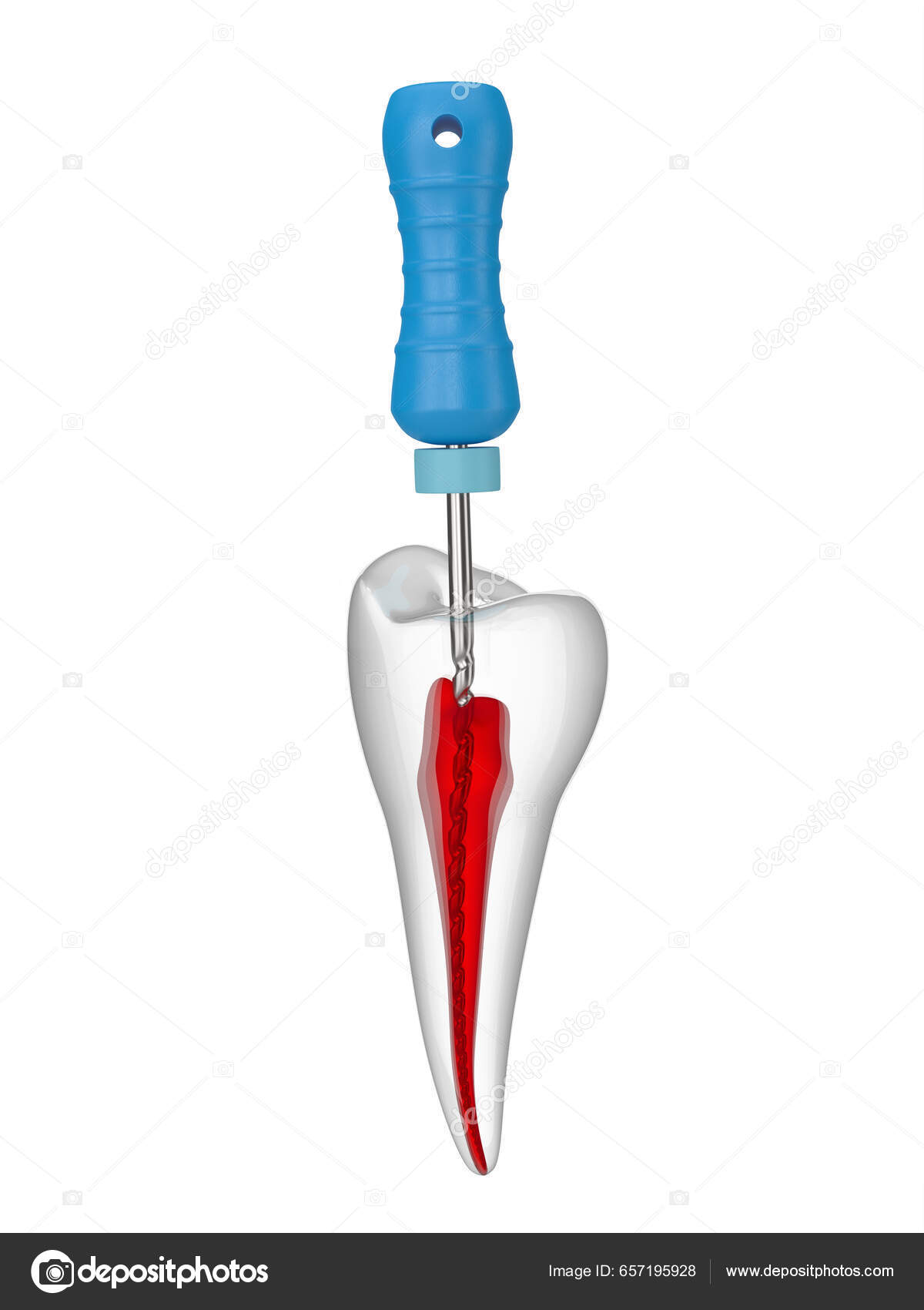 Render Premolar Tooth Endodontic File White Background Endodontic ...
