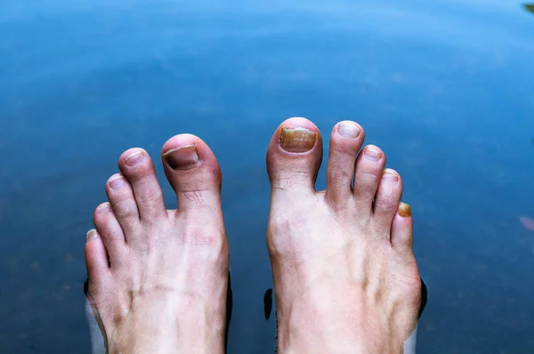 Macro toes Stock Photos, Royalty Free Macro toes Images | Depositphotos