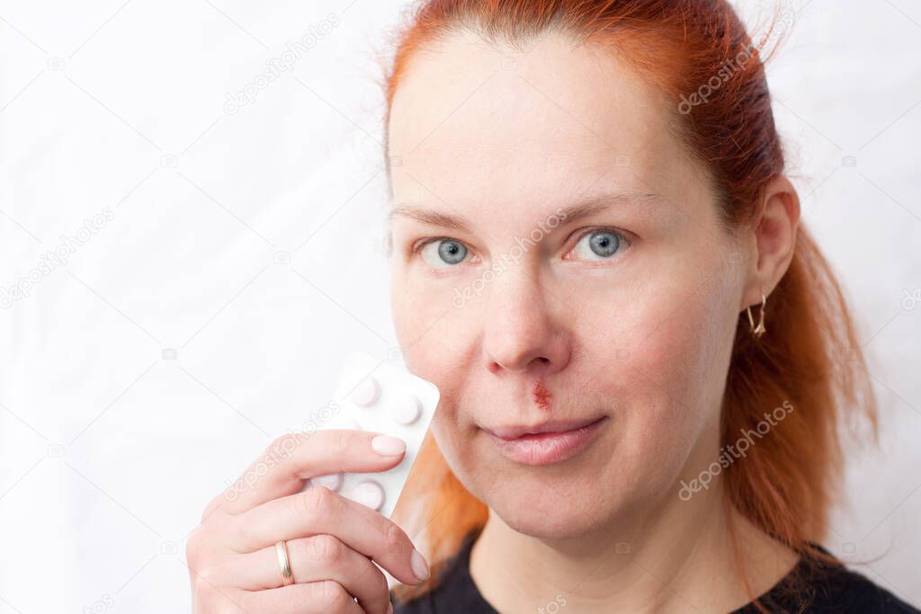 Retrato de mujer de mediana edad con herpes sobre el labio superior ...