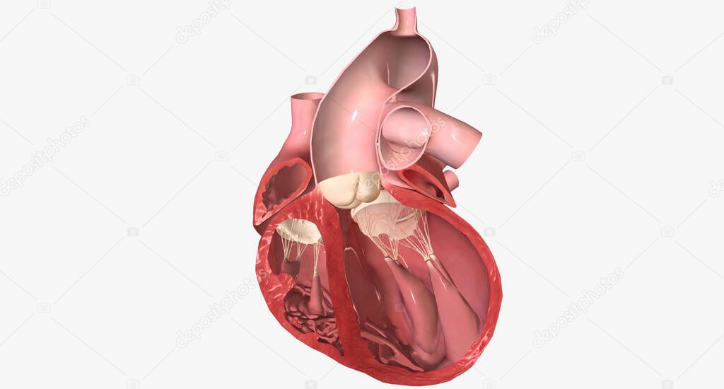 Insuficiencia cardíaca congestiva Renderizado 3D sistólico del lado ...