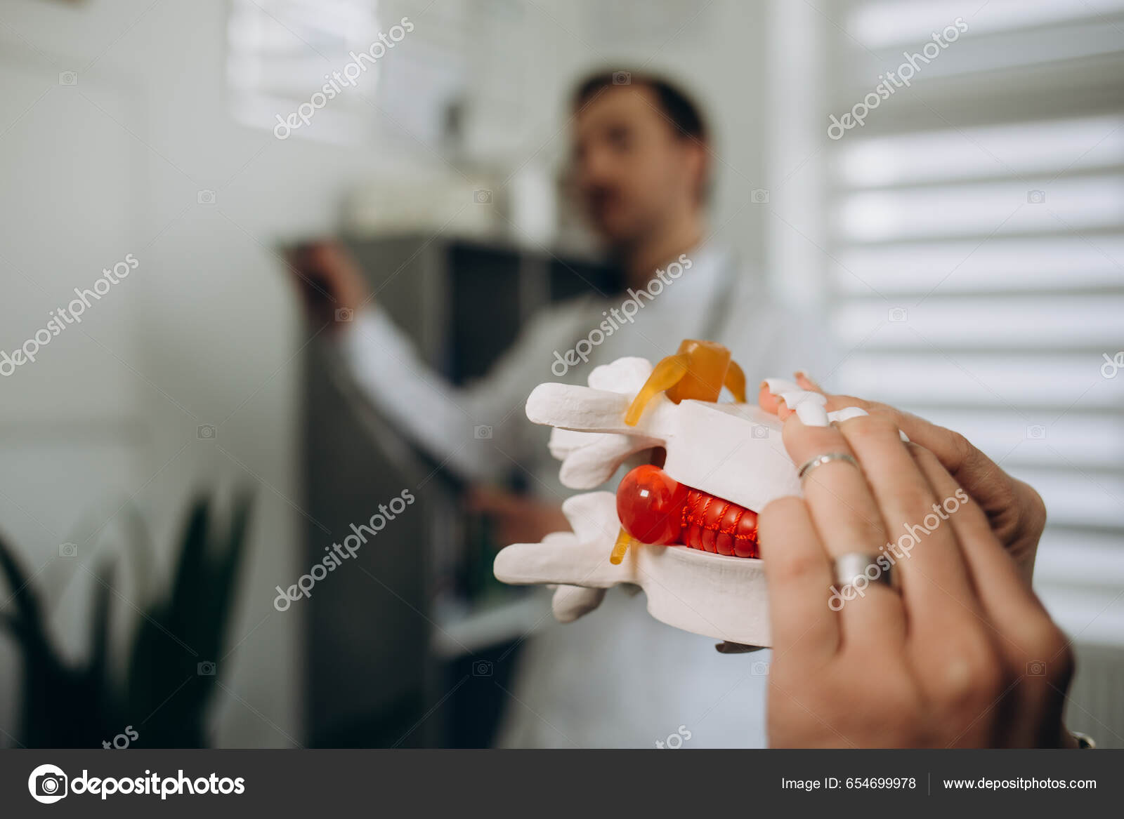 Model Human Spine Inflamed Intervertebral Hernia Black Background ...