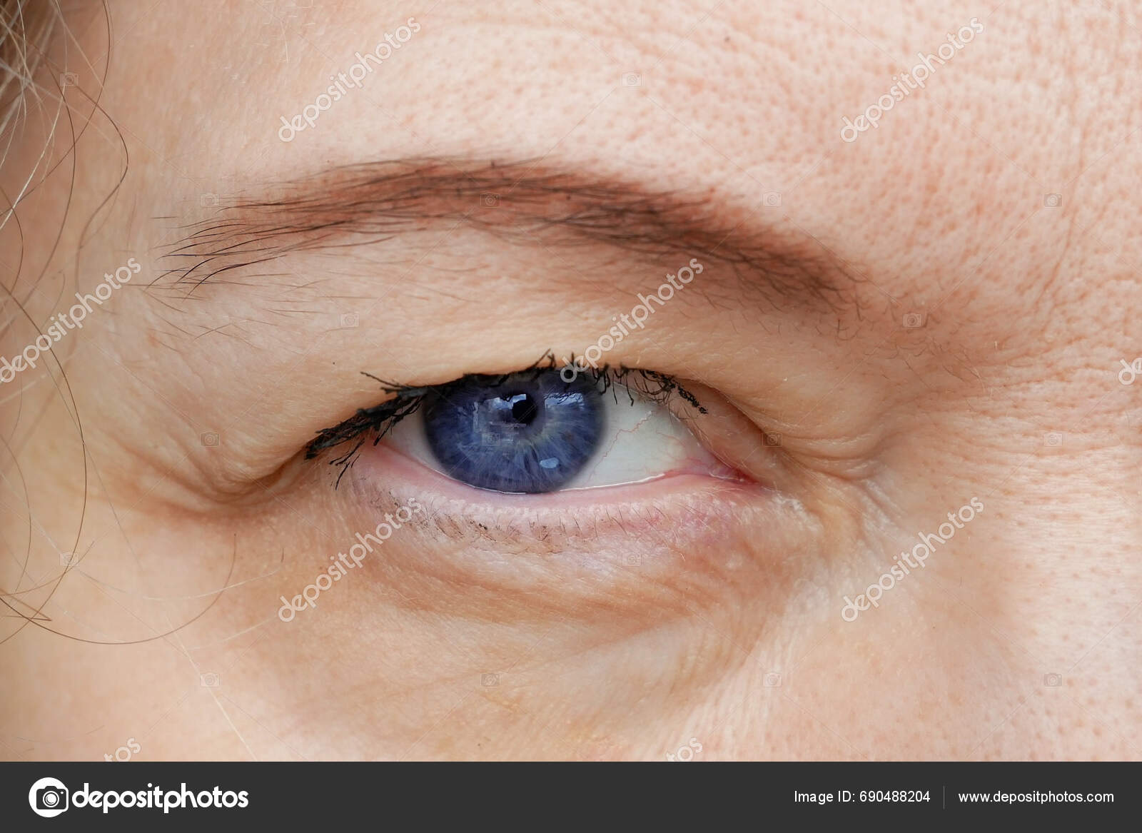 Middle Aged Female's Eye Drooping Eyelid Making Eyebrow Makeup Ptosis ...