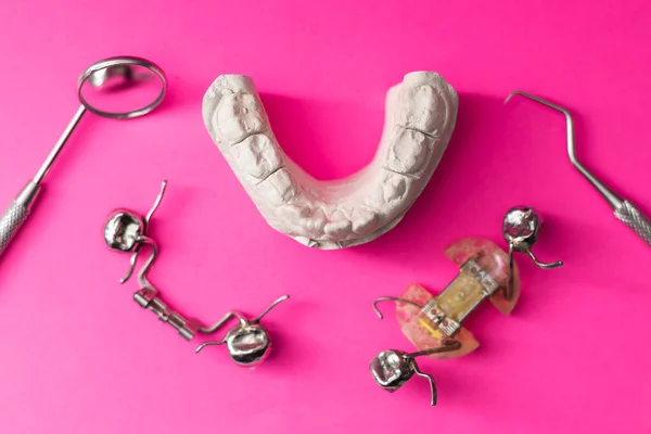 Dental Casting Gypsum Model Human Jaws Crooked Teeth Distal Bite ...