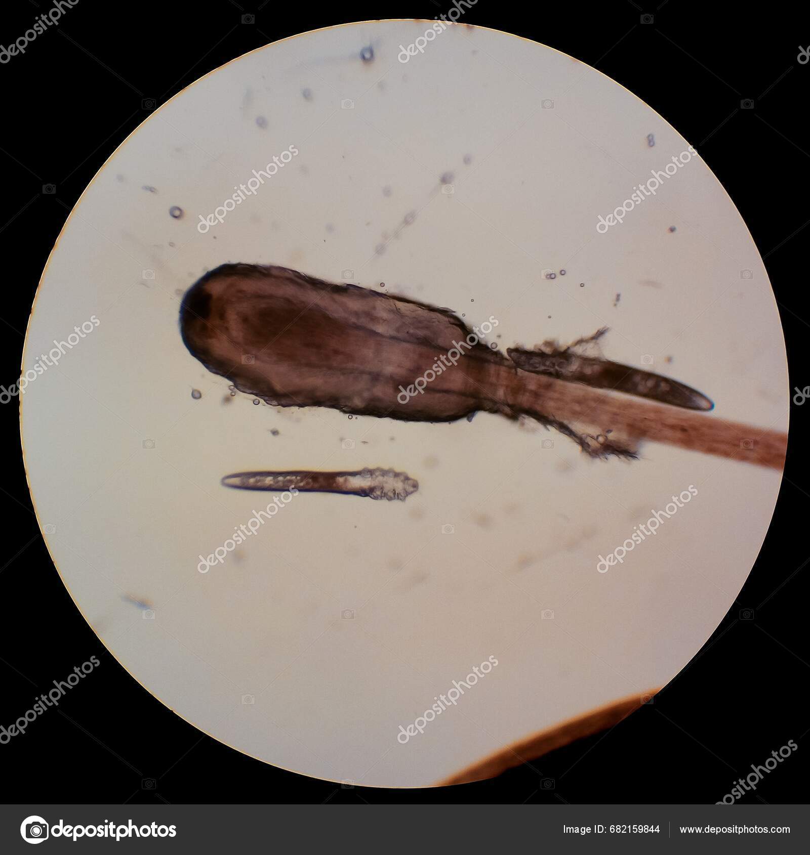Demodex Folliculorum Parasitic Mite Eyelashes Human Eye Microscope ...