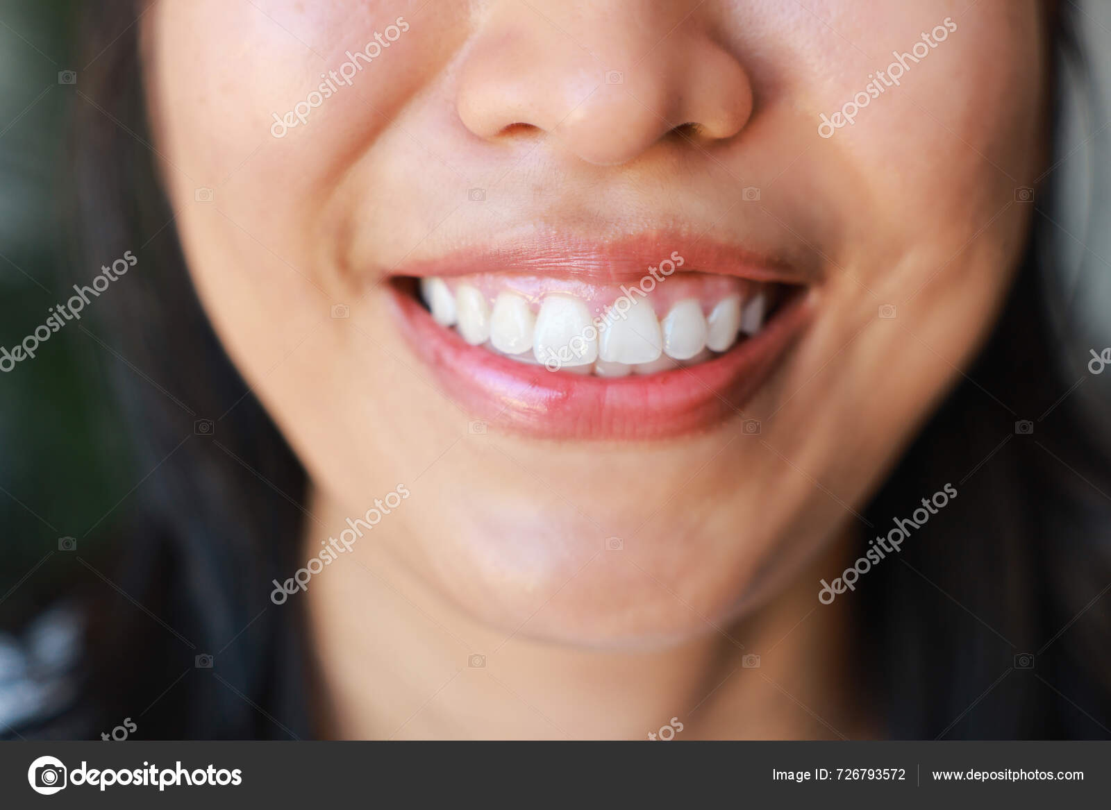Close Perfect White Teeth Smile Young Asia Woman Image Symbolizes ...