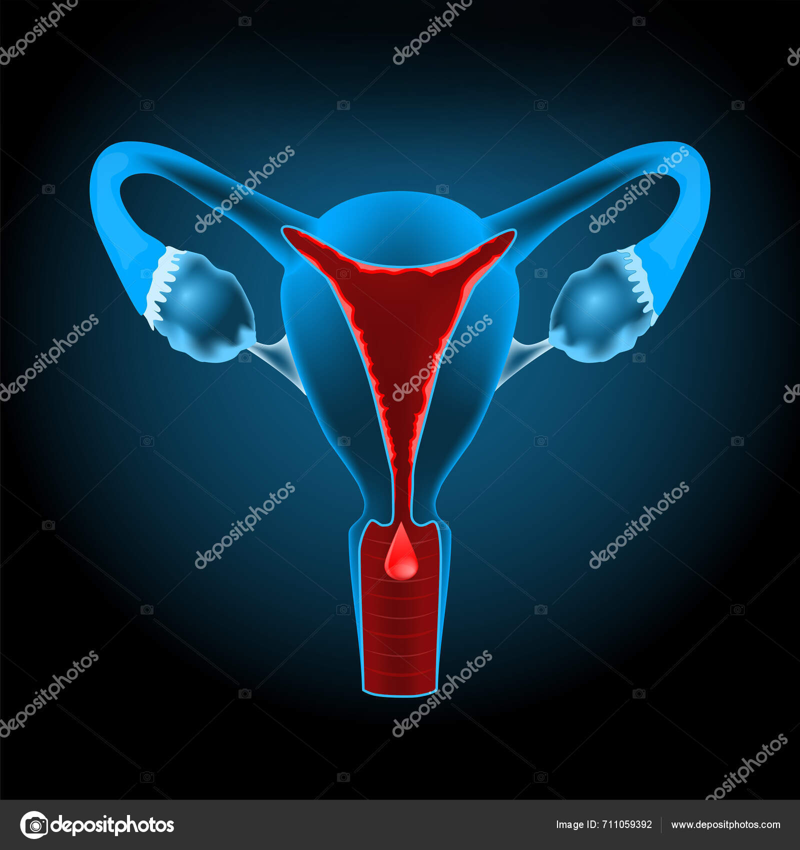 Sangrado Uterino Menstruación Vista Corta Del Útero Sistema Reproductor