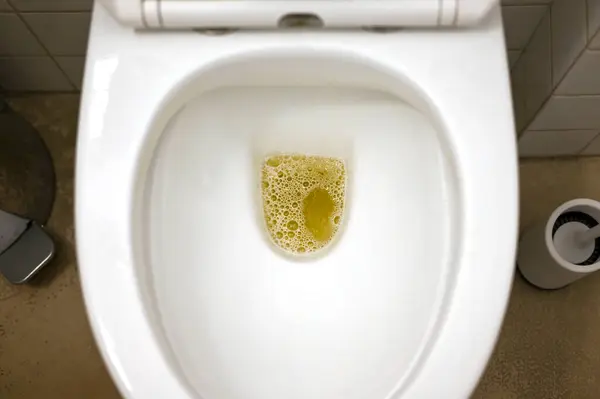 Normal Urine In Toilet How To Maintain Your Toilet Bowls Singapore