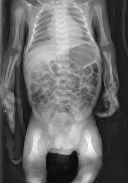 Baby in pelvis fotos de stock, imágenes de Baby in pelvis sin royalties ...