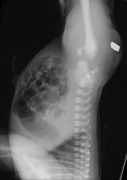 Pediatric ct scan Stock Photos, Royalty Free Pediatric ct scan Images ...