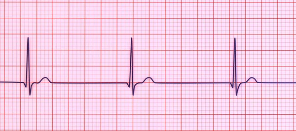 Female ecg Stock Photos, Royalty Free Female ecg Images | Depositphotos