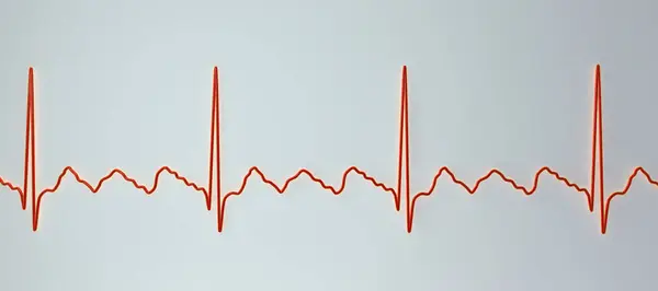 Abnormal Ekg Background Stock Electrocardiography Wikipedia