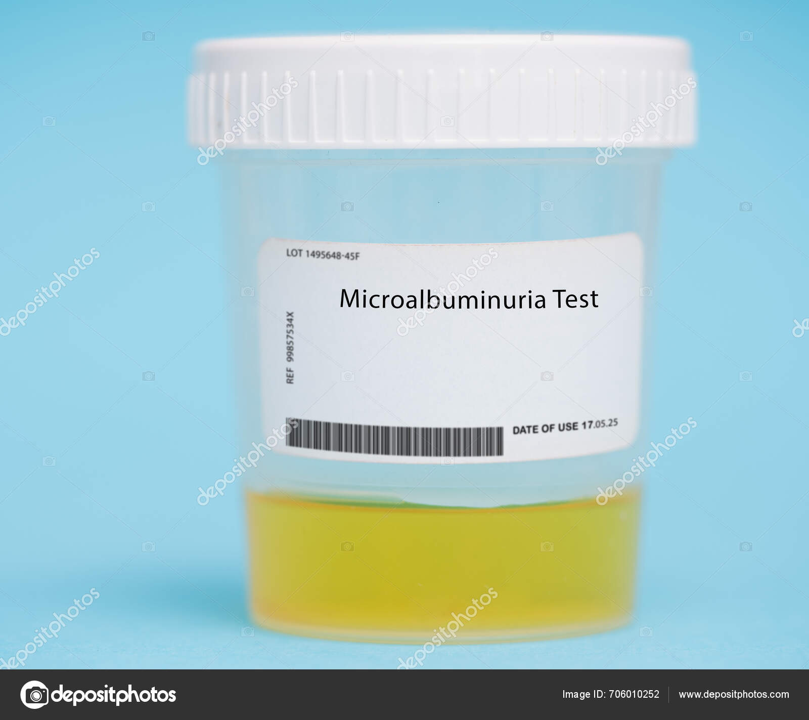 Microalbuminuria Test Test Measures Levels Albumin Protein Can Indicate ...