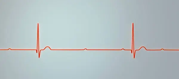 Ecg dead Stock Photos, Royalty Free Ecg dead Images | Depositphotos