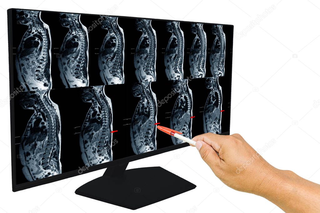 El médico informó de las exploraciones por resonancia magnética de la ...