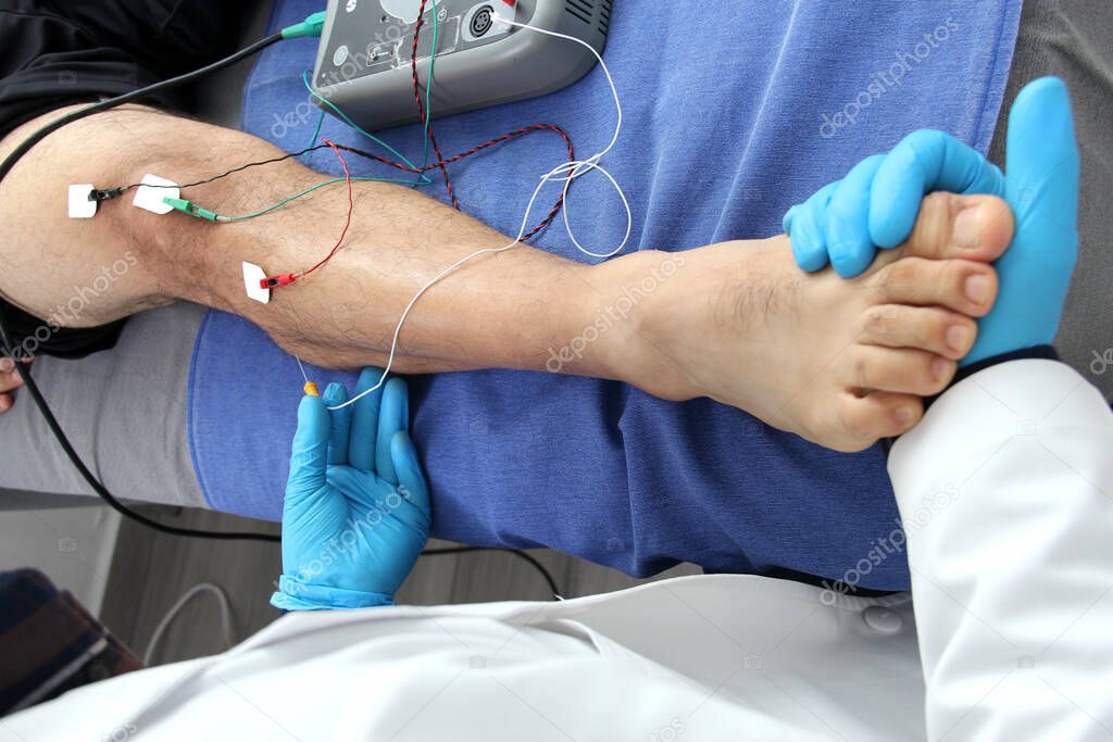 Electromiografía EMG y potencial evocado somatosensorial PEV de las extremidades inferiores ...