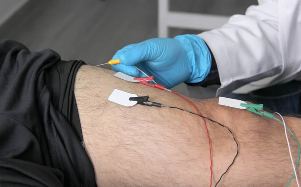 Electromiografía EMG y potencial evocado somatosensorial PEV de las extremidades inferiores ...