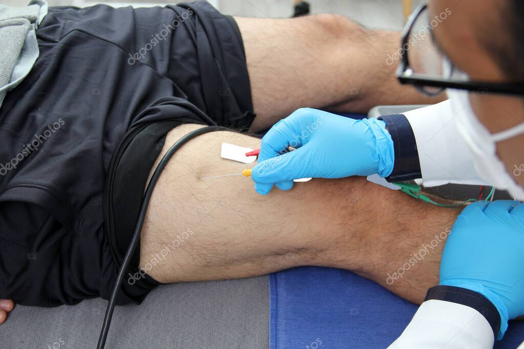 Electromiografía EMG y potencial evocado somatosensorial PEV de las extremidades inferiores ...