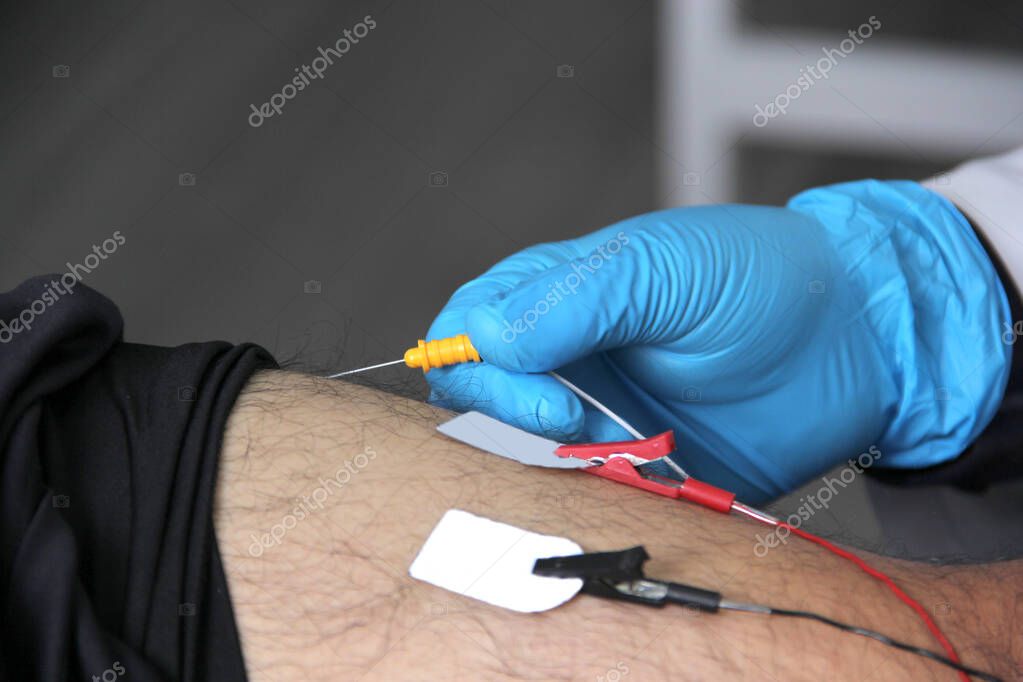 Electromyography EMG and Somatosensory Evoked Potential PEV of lower ...