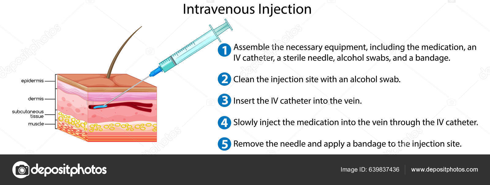 Intravenous Injection Diagram