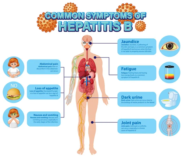 Informative Poster Common Symptoms Hiv Illustration Stock Vector By