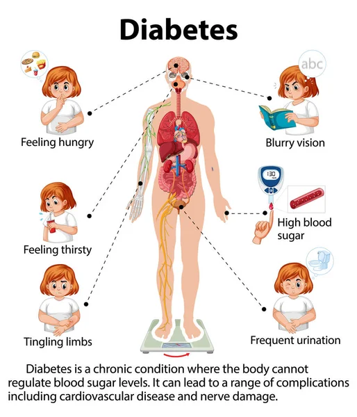 Infographic Illustrating Effects Diabetes Human Body Stock Vector by ...