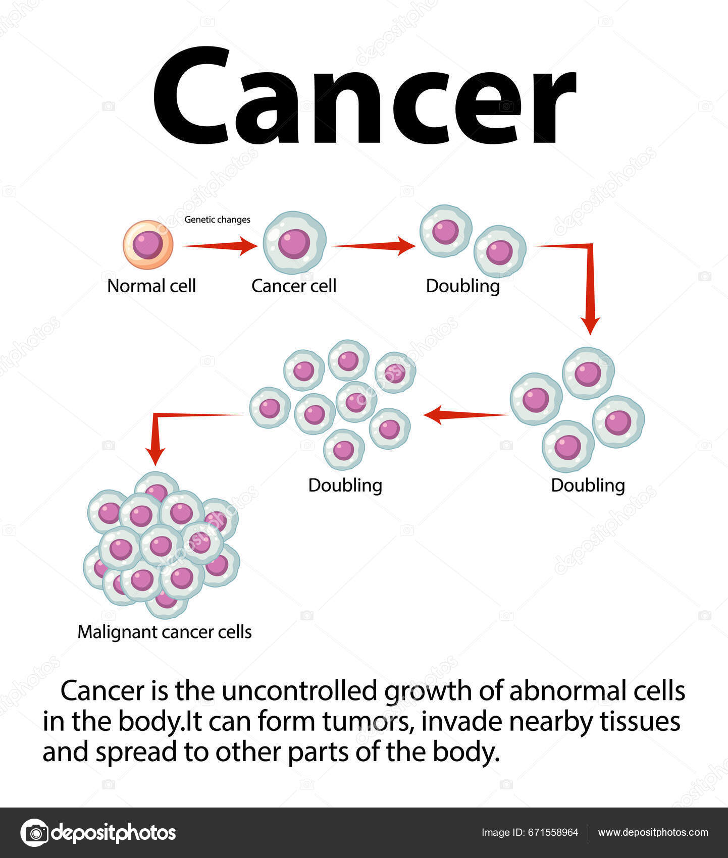 Ilustrasi Infografis Menampilkan Perkembangan Dan Pengolahan Sel Kanker ...