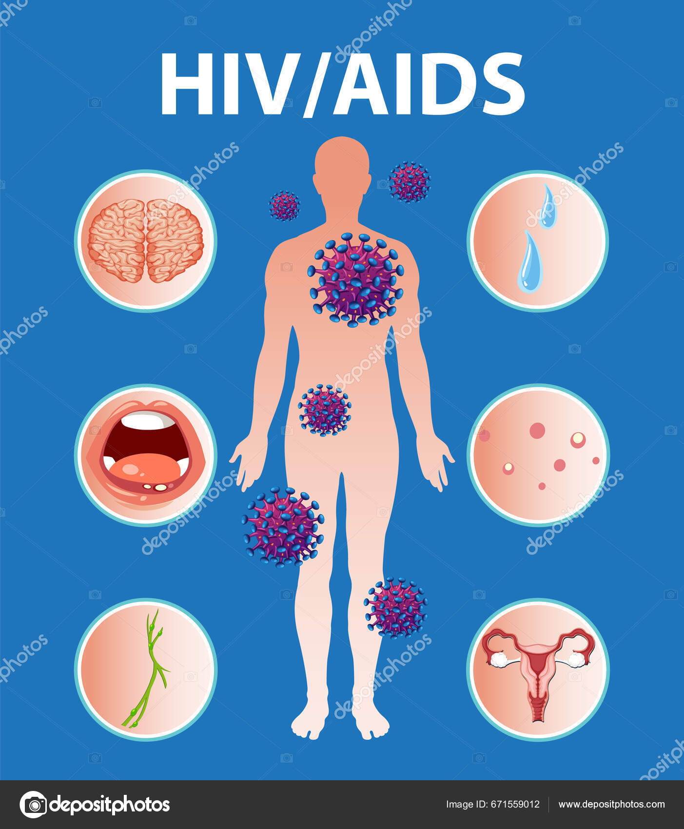 Virus SIDA Del VIH Stock De Ilustración De Medicina, 44% OFF