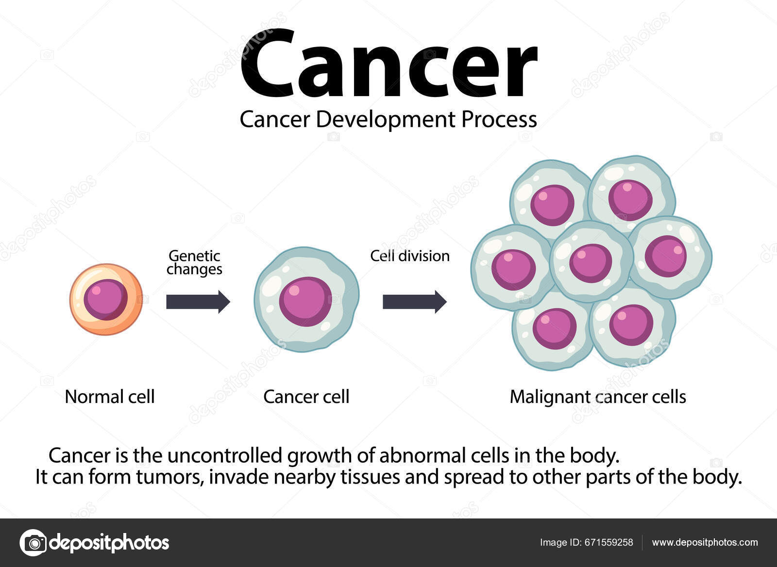 Illustrated Infographic Depicting Development Processing Cancer Cells ...