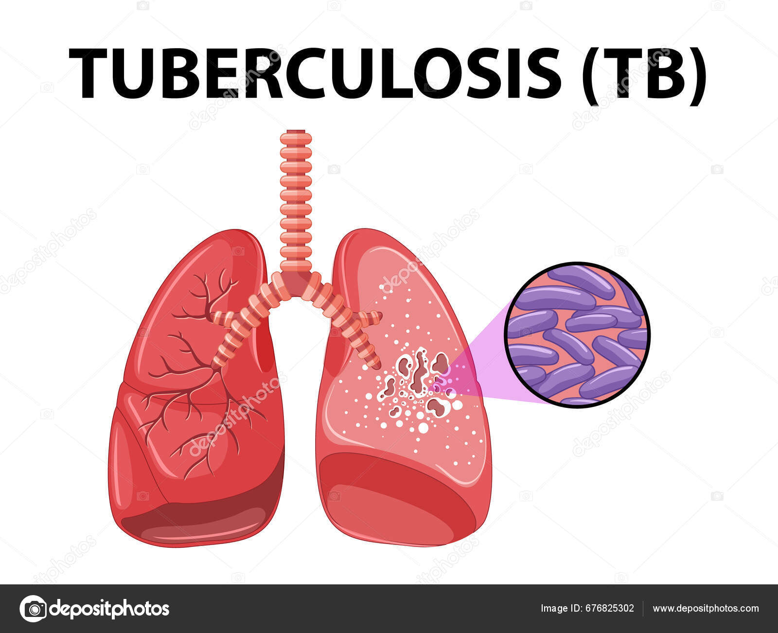 Infográfico Ilustrado Mostrando Educação Médica Anatomia Pulmonar ...