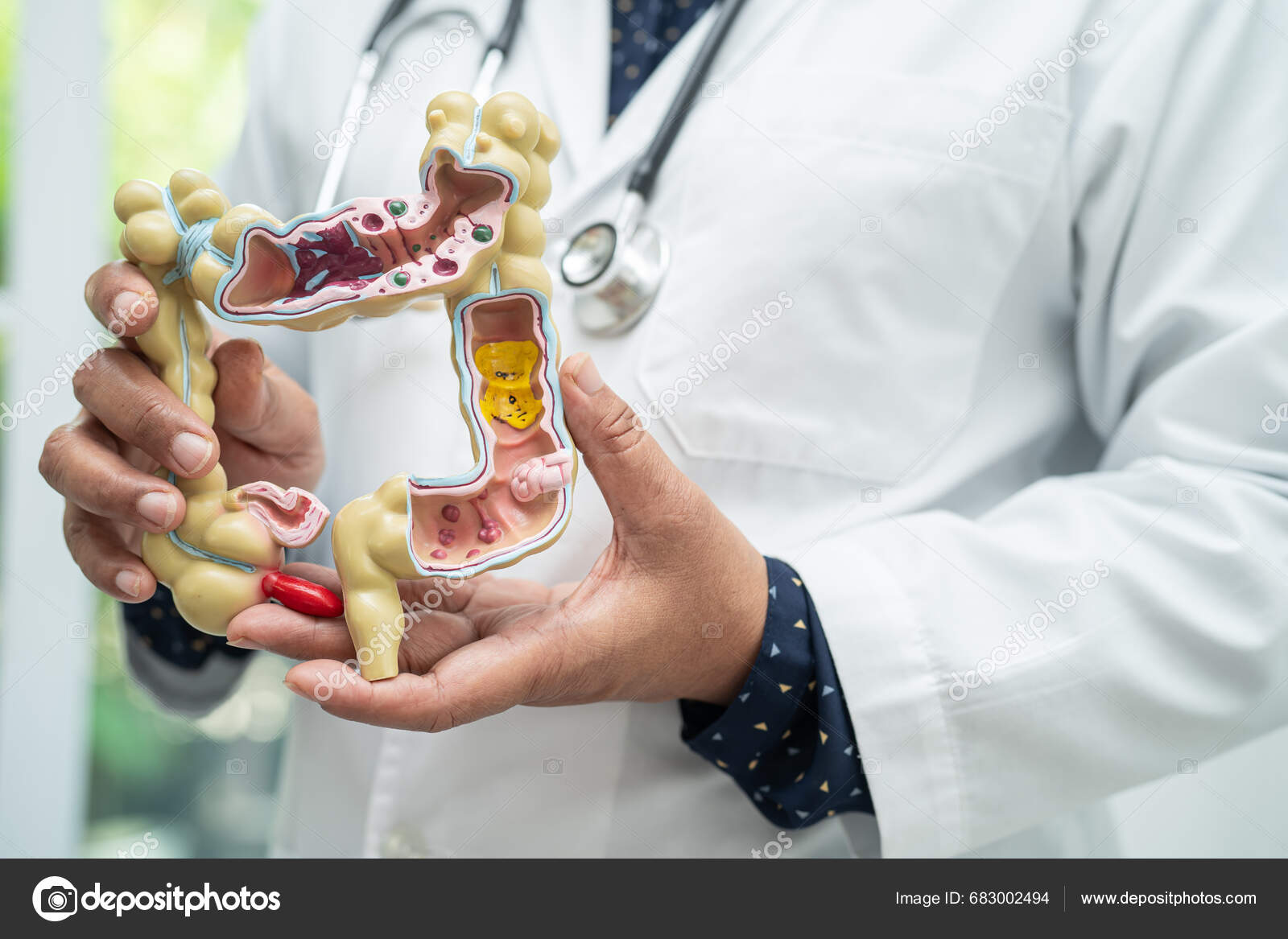 Intestino Apéndice Sistema Digestivo Médico Que Sostiene Modelo ...