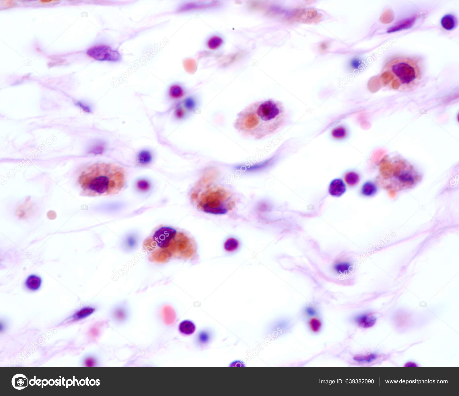 Macrophage Phagocytosis Microscope