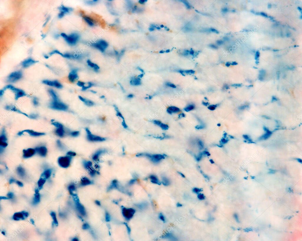 Kupffer cells are macrophages of the liver. Colloidal iron acts as a ...