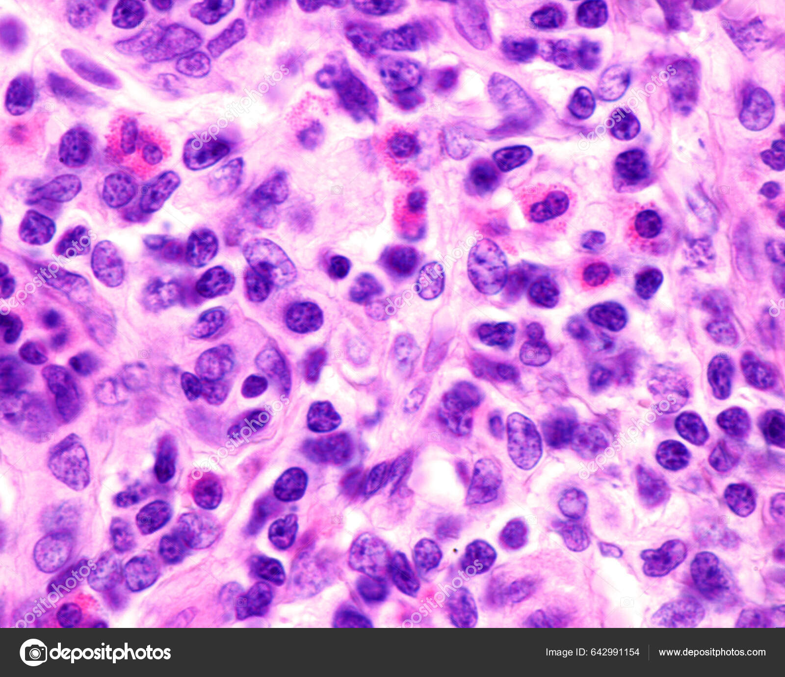 Light Microscope Micrograph Showing Eosinophil Granulocytes Lamina ...