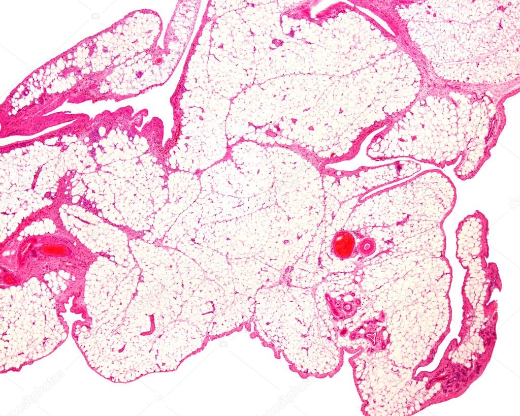 Very low magnification light microscope micrograph of white adipose ...