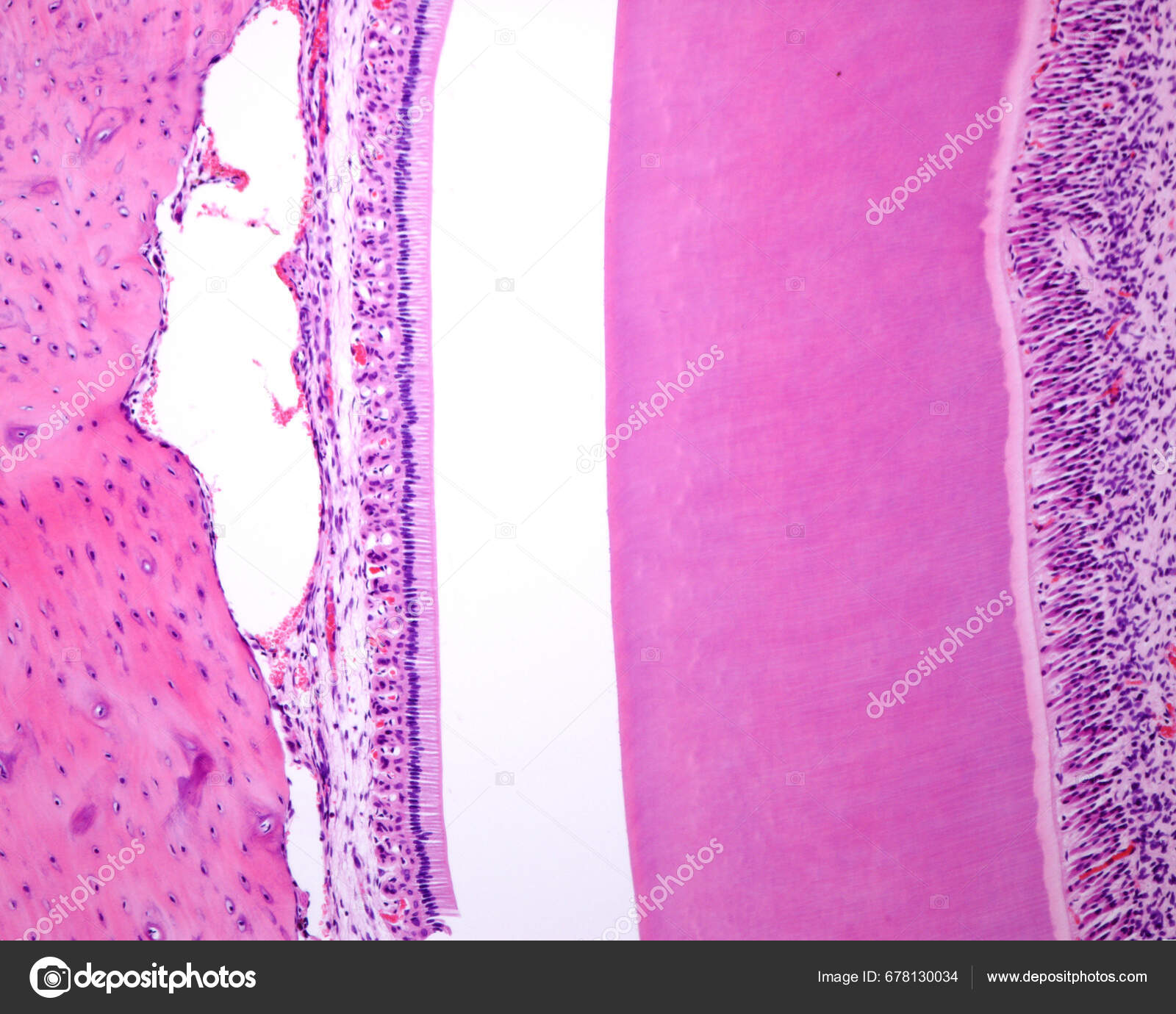 Rabbit Molar Tooth Showing Left Right Alveolar Bone Ameloblasts Enamel ...
