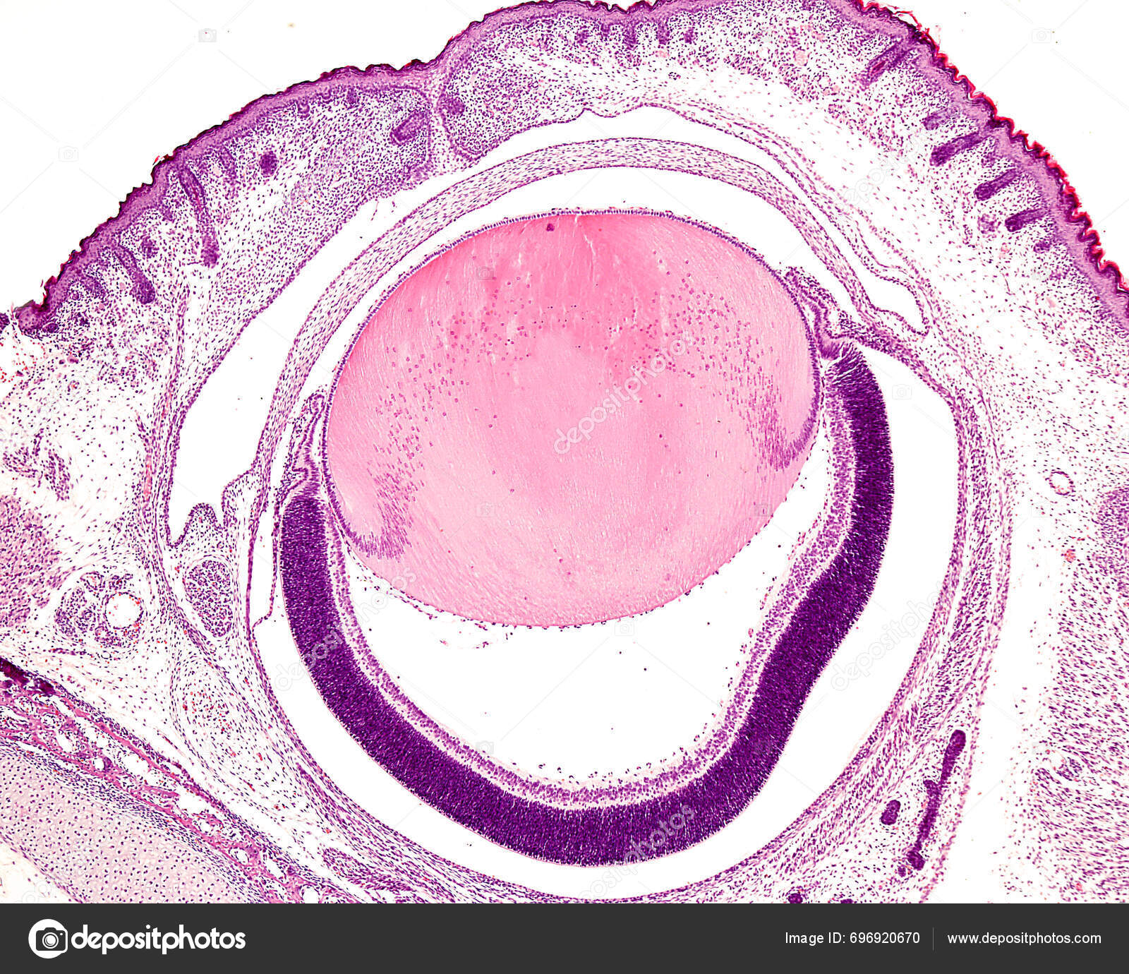 Very Low Magnification Light Microscope Micrograph Eye Albino Rat ...