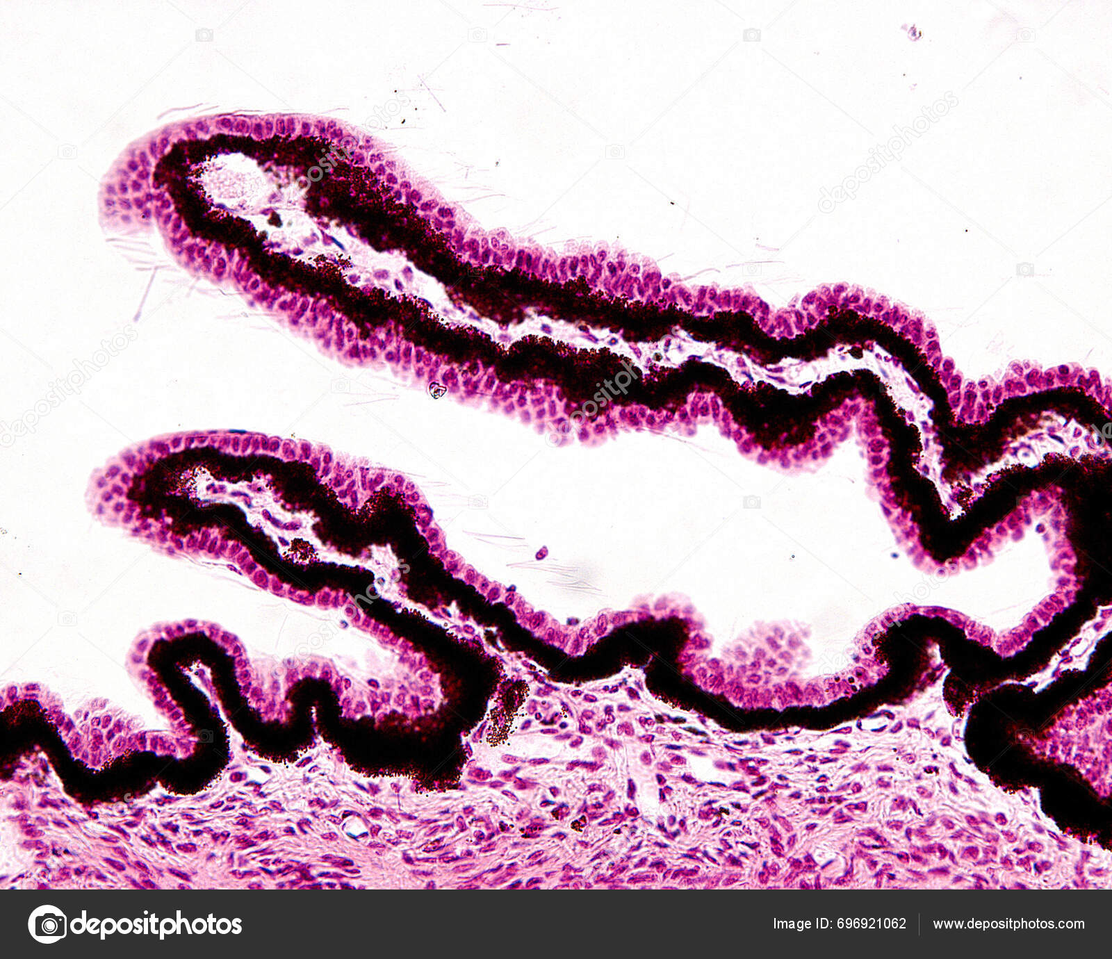 Ciliary Body Two Ciliary Processes Lined Double Epithelial Layer Non ...