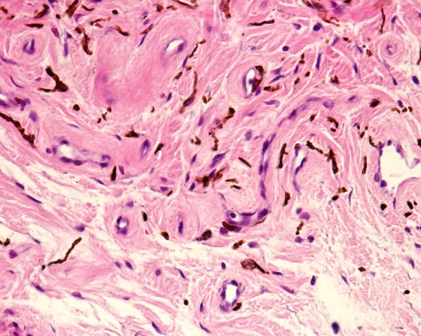 Light Microscope Micrograph Showing Top Dense Connective Tissue Sclera ...