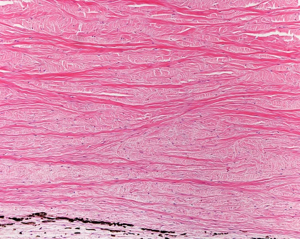 Light Microscope Micrograph Showing Top Dense Connective Tissue Sclera ...