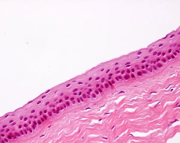 Dermatofagia Stock Photos, Royalty Free Dermatofagia Images | Depositphotos