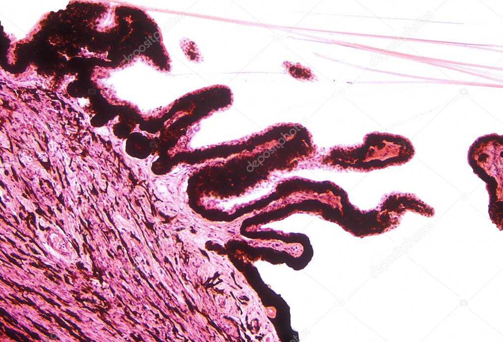 Cuerpo ciliar que muestra los pliegues típicos o procesos ciliares ...