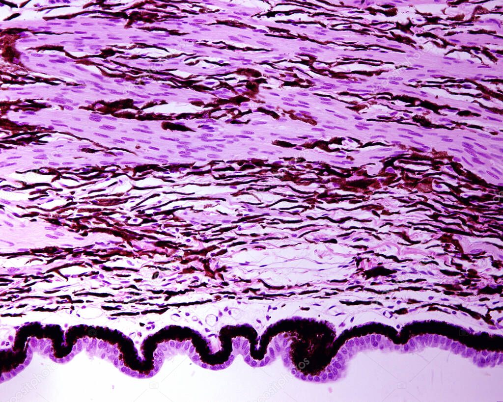 Cuerpo ciliar humano. Desde arriba, el estroma del cuerpo ciliar ...