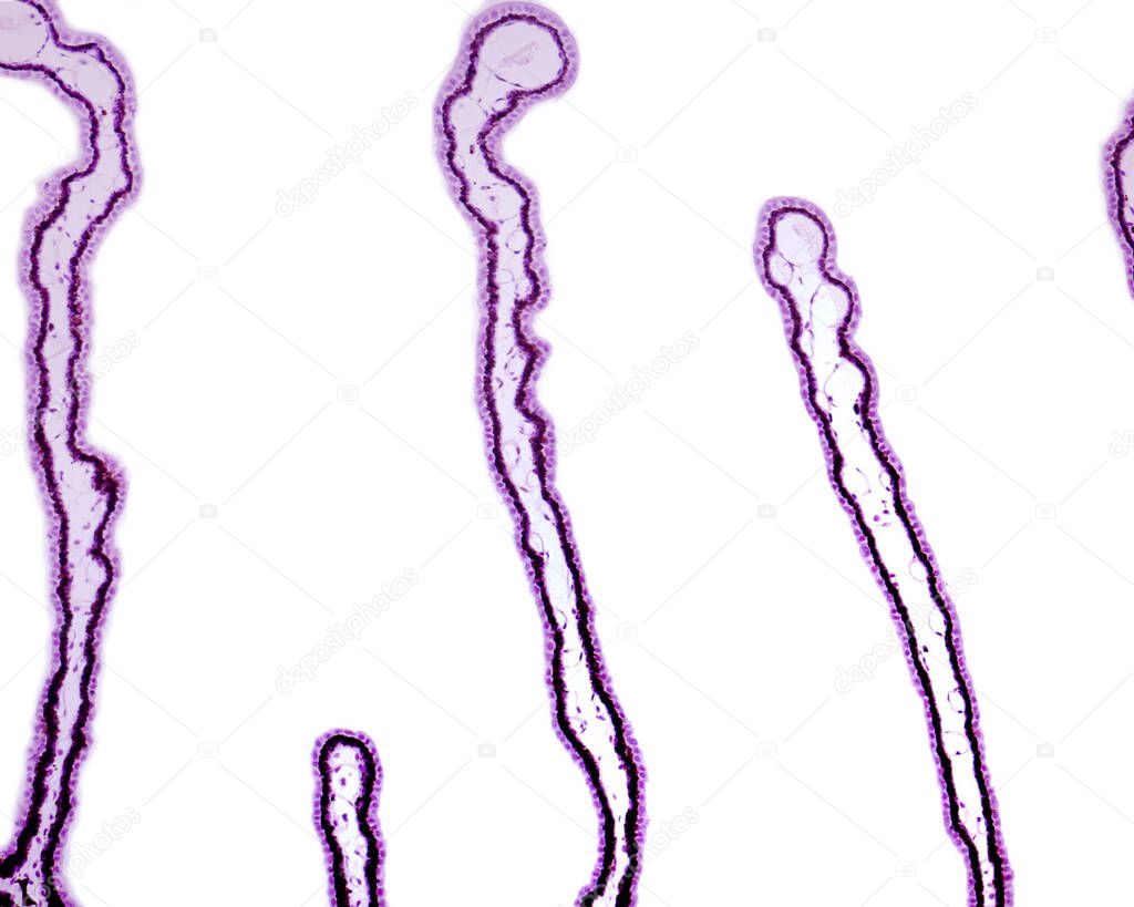 Cuerpo ciliar. Procesos ciliares aislados que muestran claramente la ...