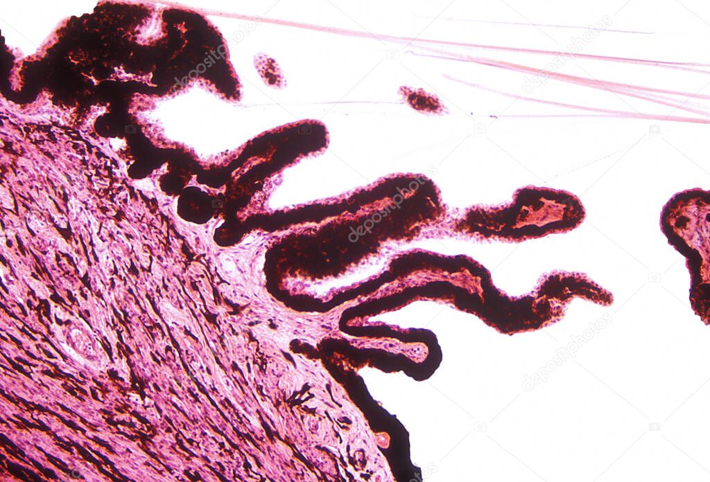 Cuerpo ciliar que muestra los pliegues típicos o procesos ciliares ...
