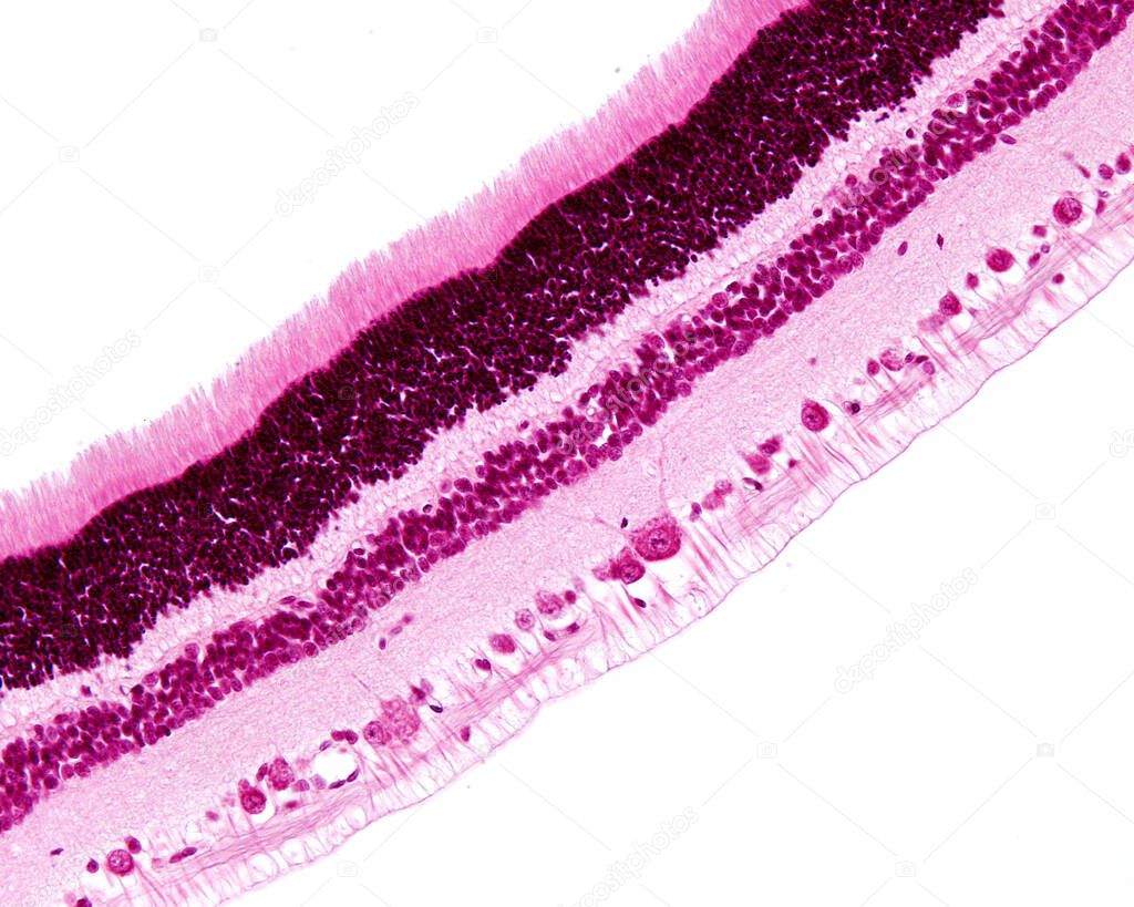 Capas de retina, micrografía ligera. De arriba a abajo: varillas y ...