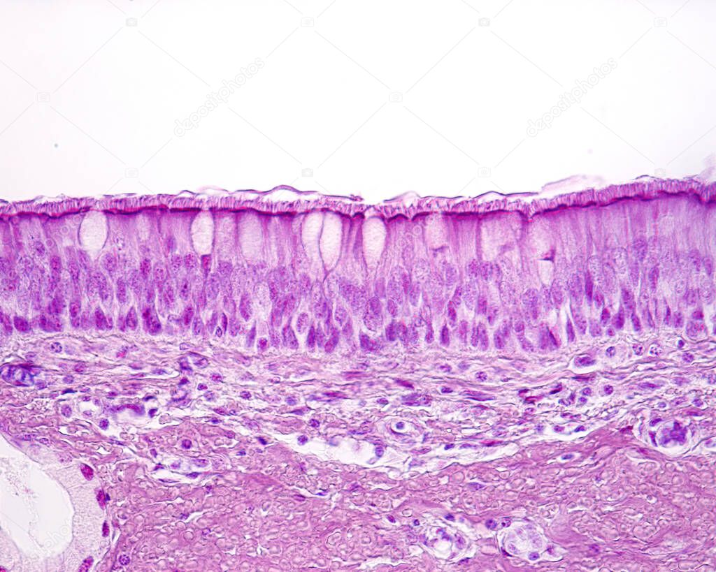 Epitelio columnar ciliado pseudoestratificado de la tráquea (epitelio ...