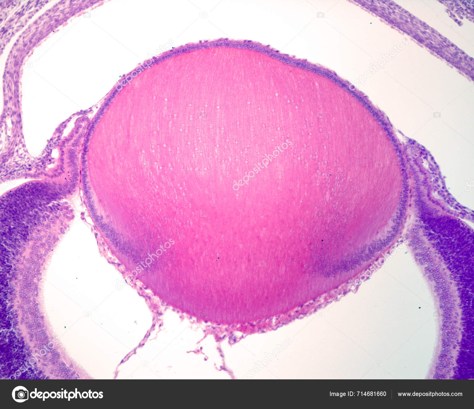 Eye Lens Light Micrograph Equator Lens Developing Eye Showing ...